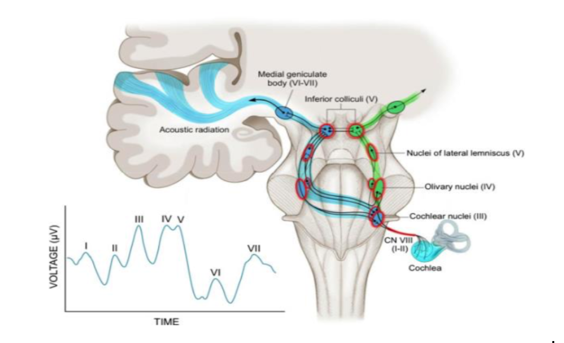 Solved Above is a diagnostic procedure called a brain stem | Chegg.com