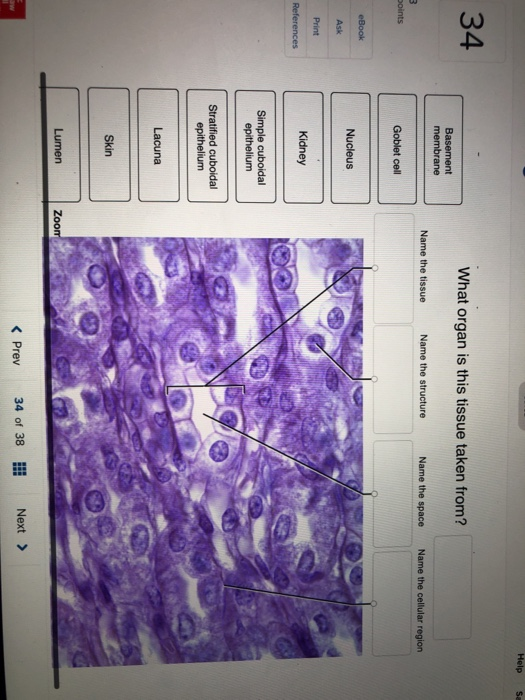Solved Click and drag the labels to correctly identify the | Chegg.com
