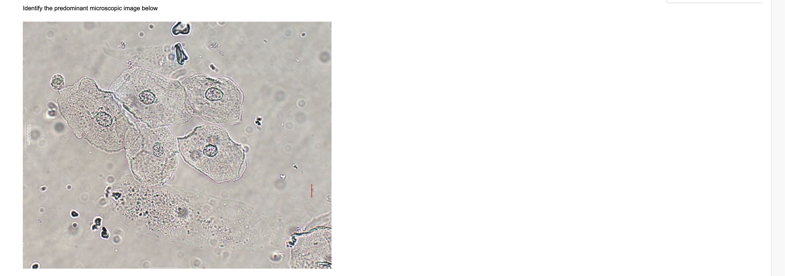 Solved Identify the predominant microscopic image | Chegg.com