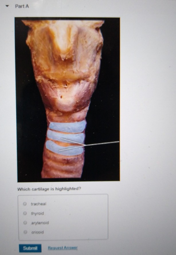 Solved Part A Which structure is highlighted? O o right main | Chegg.com