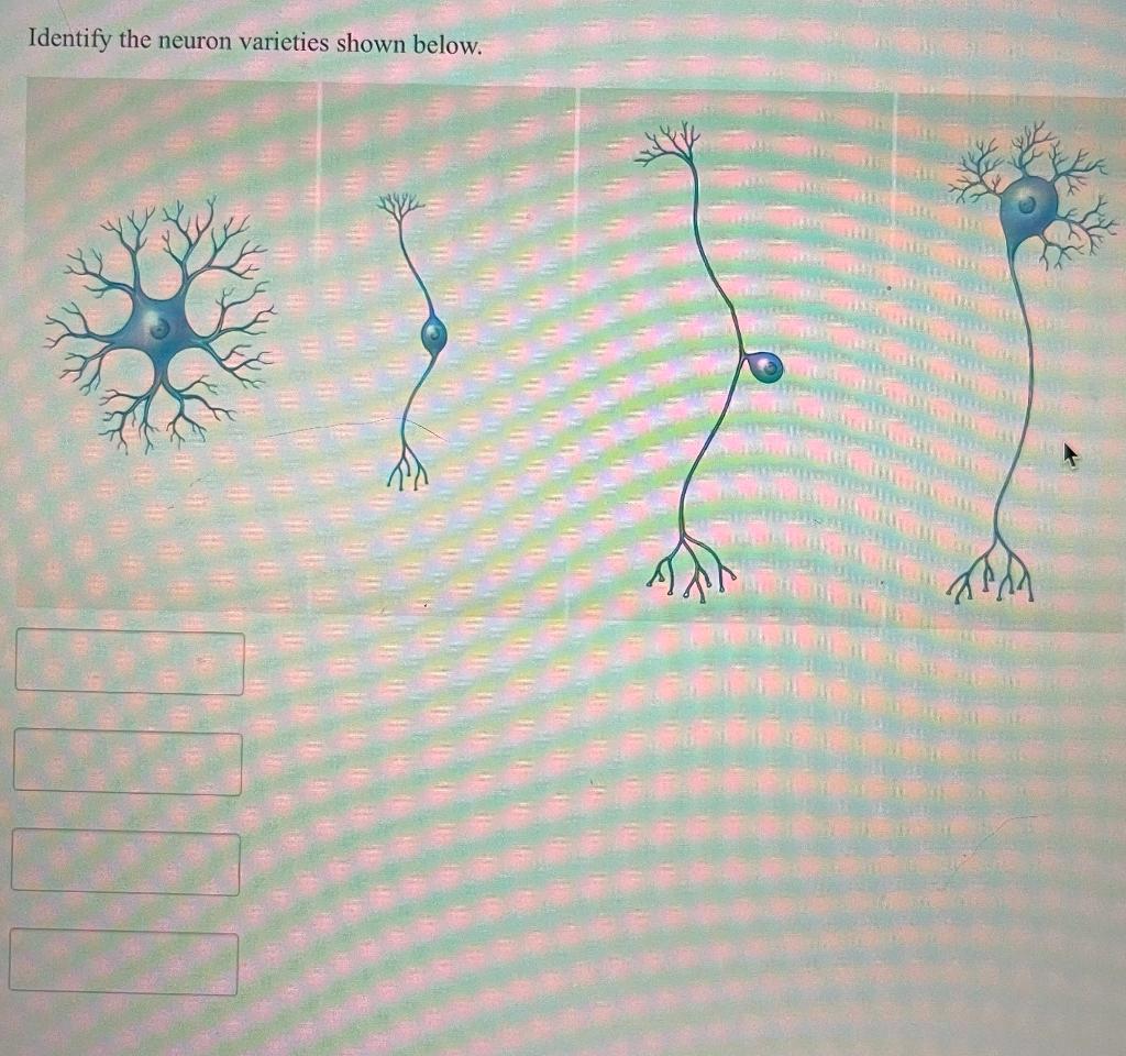 Solved Identify the neuron varieties shown below. | Chegg.com