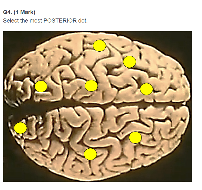 Solved Select the most POSTERIOR dot.Q4. (1 ﻿Mark)Select the | Chegg.com