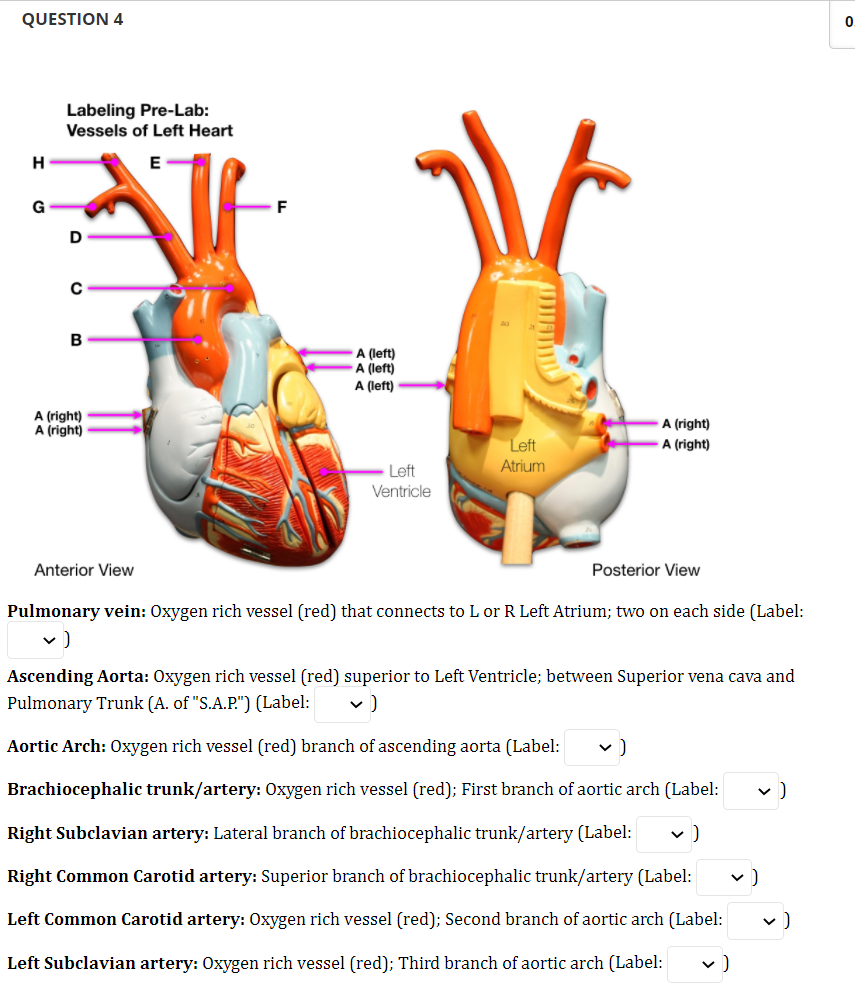 Solved Labeling Pre-Lab: Vessels of Right Heart B D (left) A | Chegg.com
