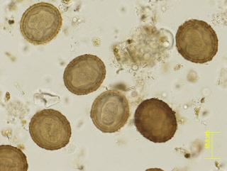 Parascaris Equorum Egg