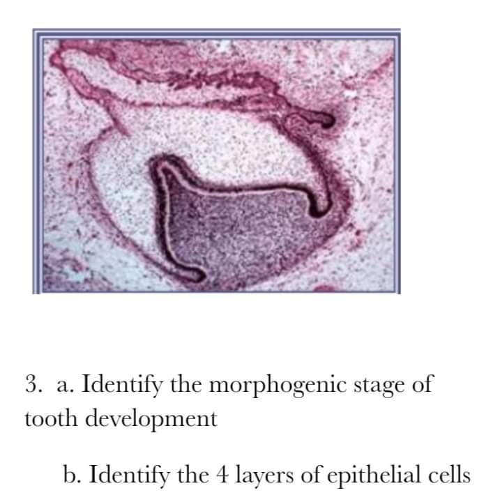 Solved 3. a. Identify the morphogenic stage of tooth | Chegg.com