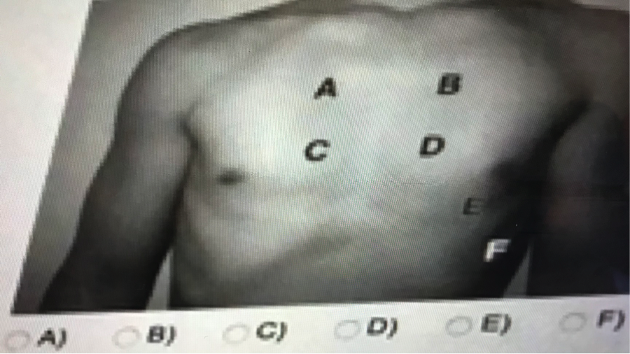 Solved During physical examination of a healthy 21 year old | Chegg.com