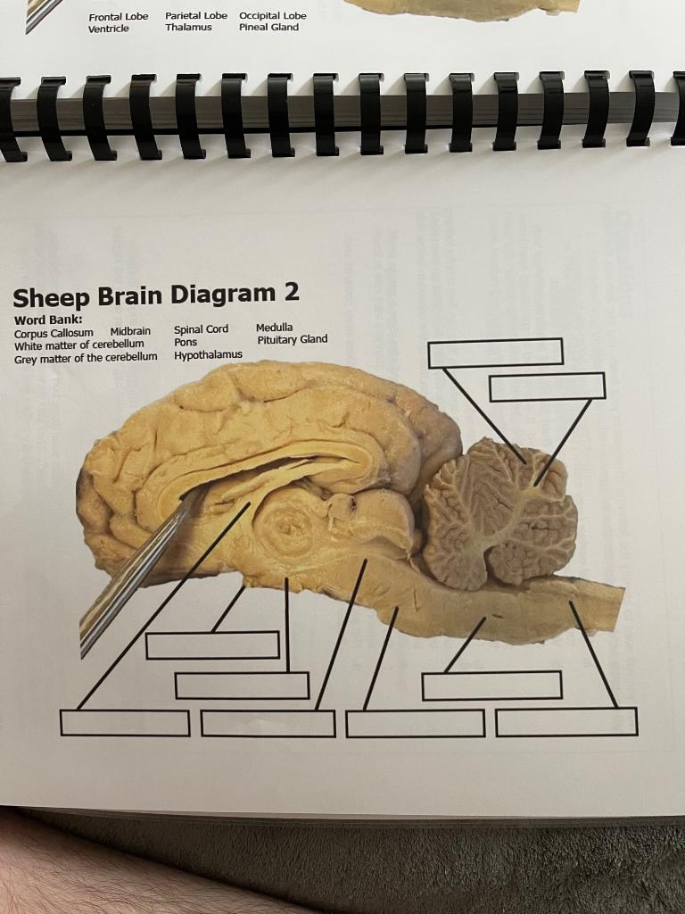Solved Sheep Brain Diagram 1 Sheep Brain Diagram 2Occipital | Chegg.com