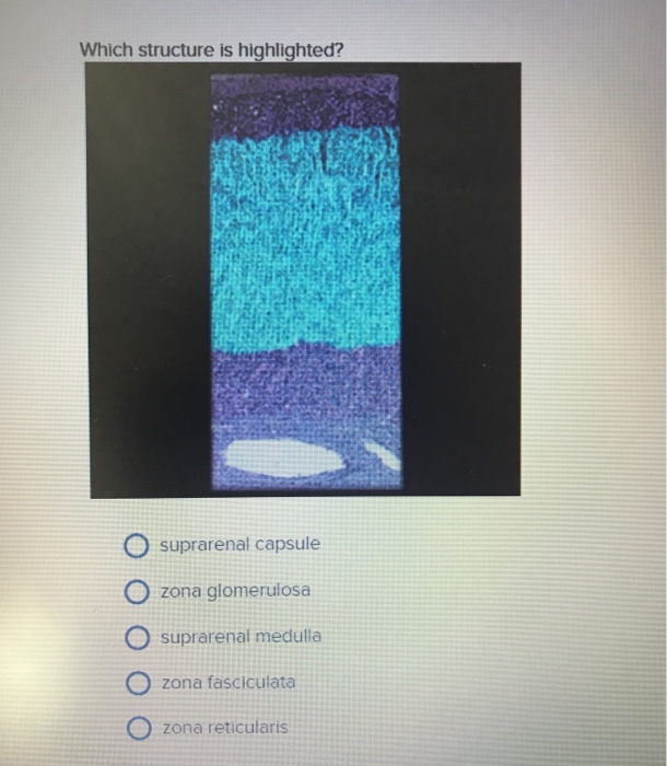 Which structure is highlighted? suprarenal capsule | Chegg.com