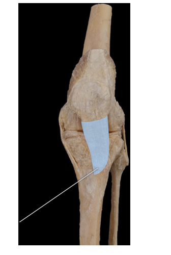 Solved Which structure is highlighted? O lateral | Chegg.com