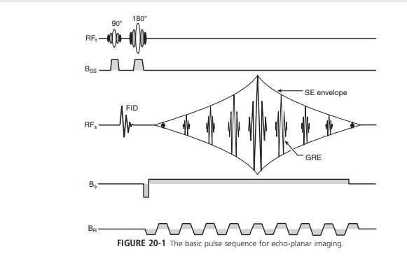 Bss: slice selection gradient Bo: phase encoding | Chegg.com