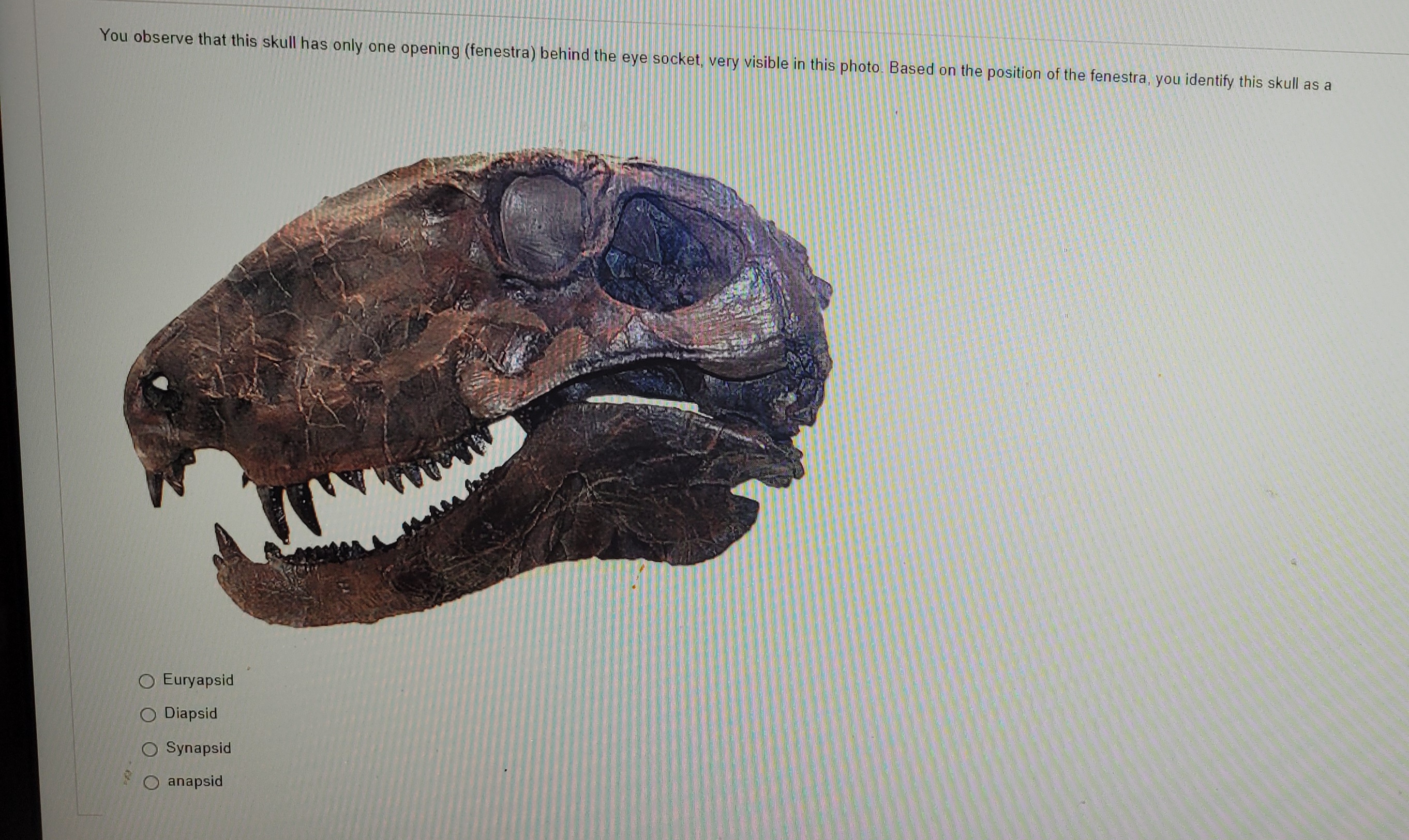 Solved You observe that this skull has only one opening | Chegg.com