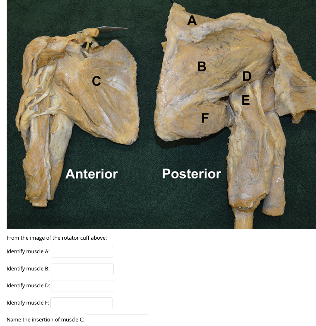 Solved From the image of the rotator cuff above: Identify | Chegg.com