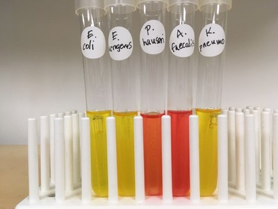 Phenol red carbohydrate broth Key to symbols and | Chegg.com