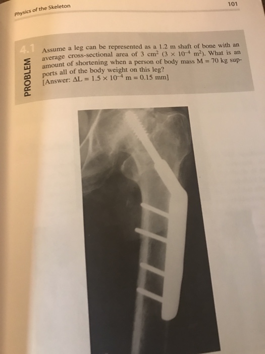 Solved of the Skeleton Physics 101 4. Assume a leg can be | Chegg.com
