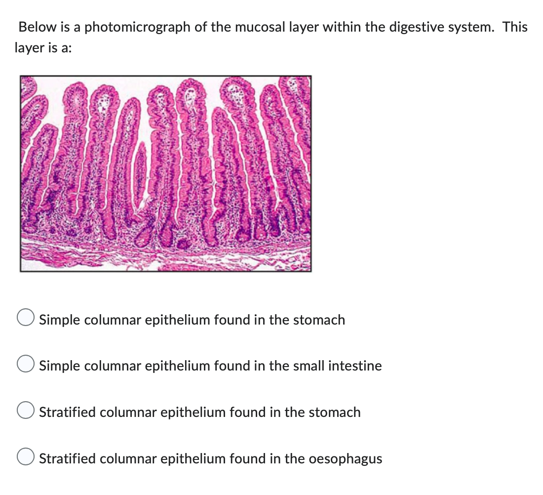 Simple Columnar Epithelium Stomach