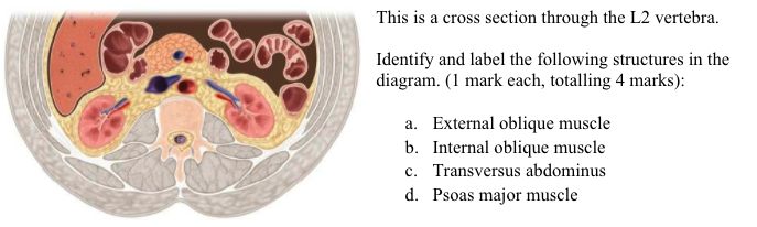 Solved This is a cross section through the L2 vertebra. | Chegg.com