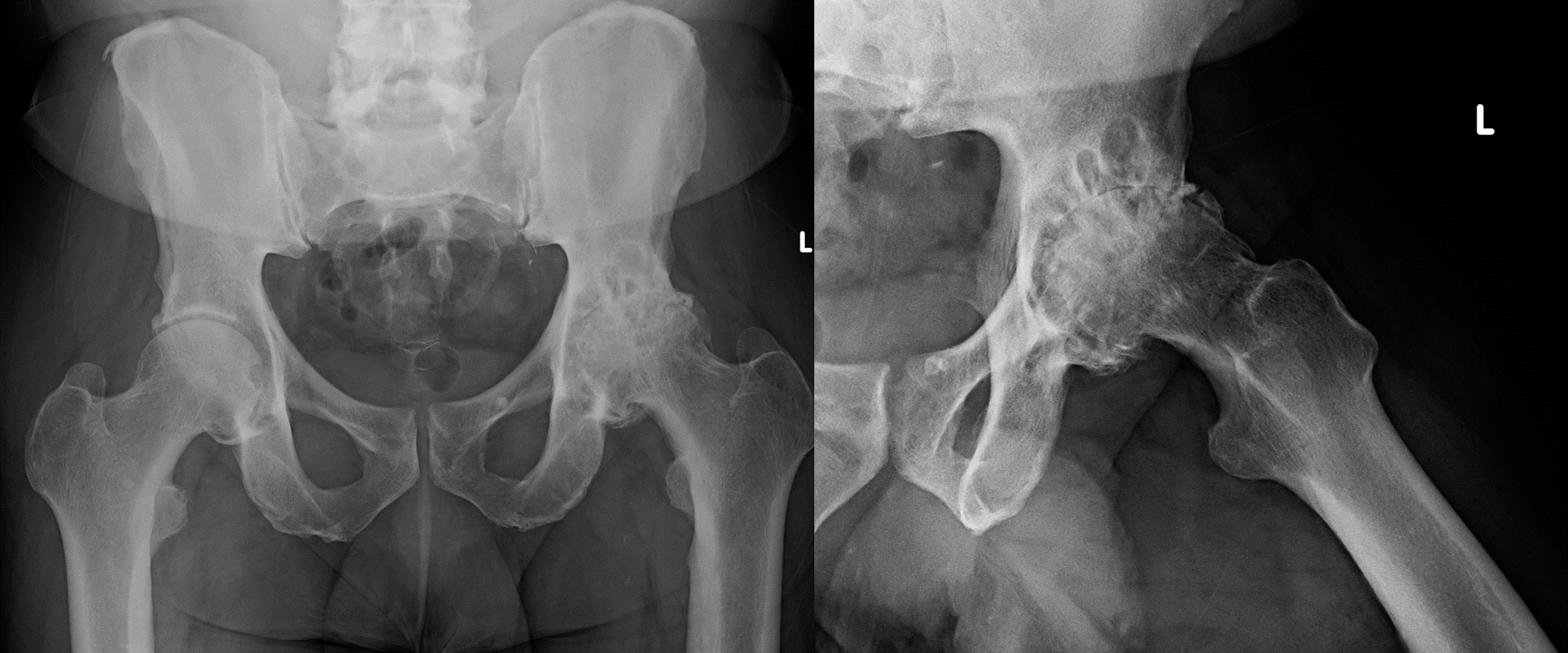 Solved History: This male patient complains of left hip | Chegg.com