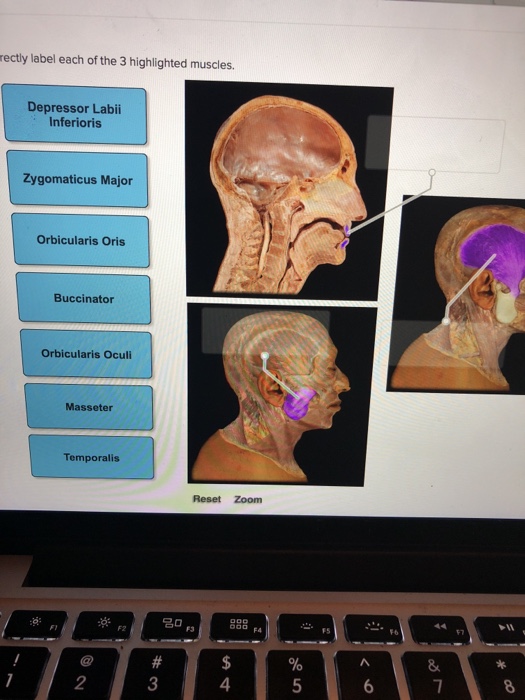 Solved Which structure is highlighted? O buccinator O | Chegg.com