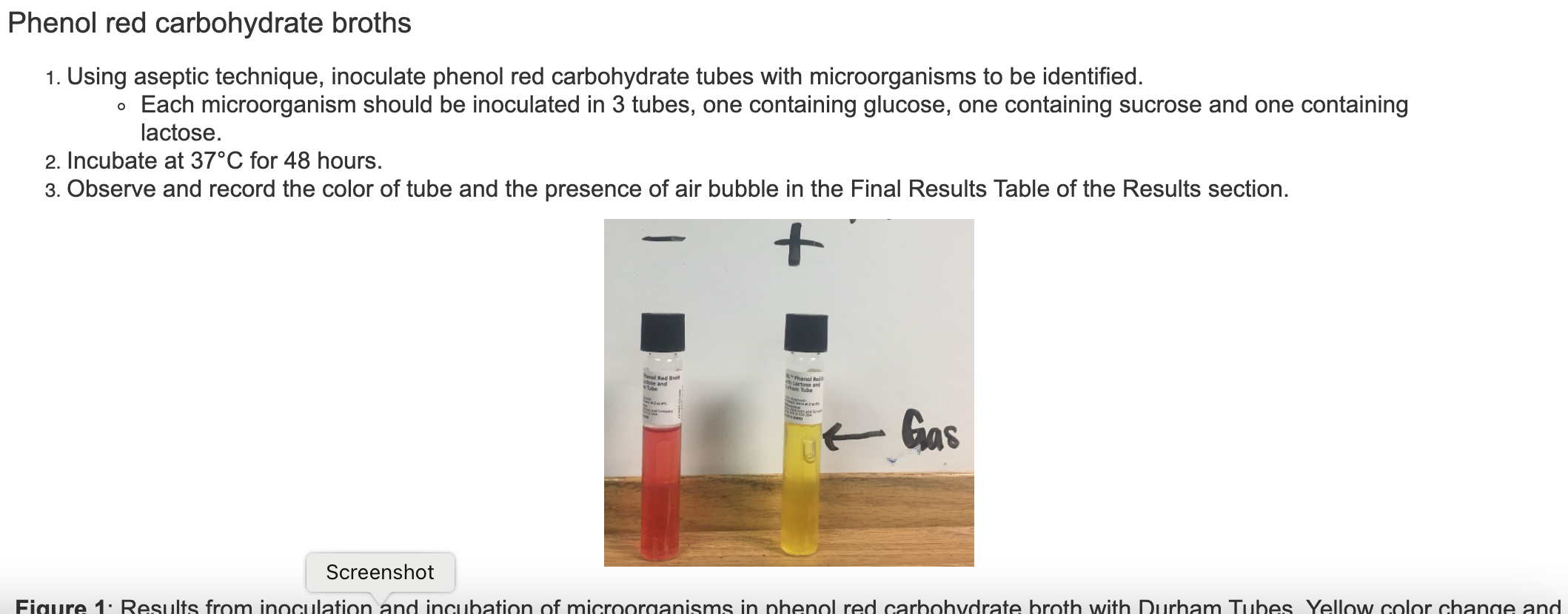Solved Microbe PR Citrate MR VP DNase Urea Nitrate Gelatin | Chegg.com