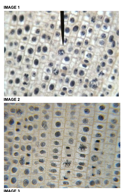 Solved Part 1 - Allium (Onion) Root Tip Procedure: The | Chegg.com