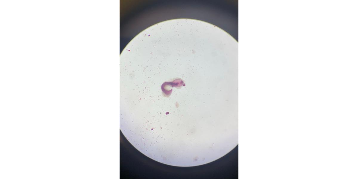Solved What is the identification of this parasite? I | Chegg.com