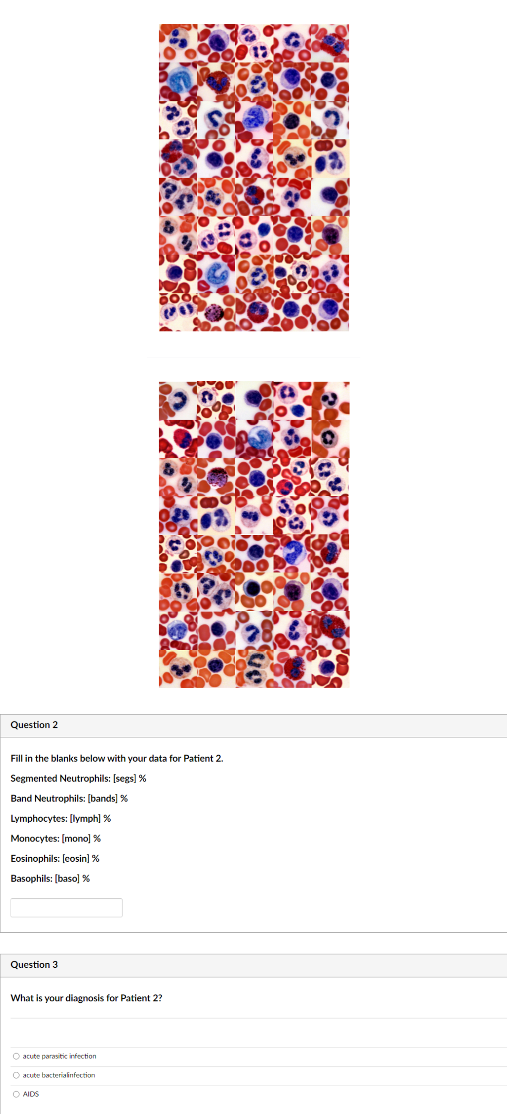 Solved Fill In The Blanks Below With Your Data For Patient