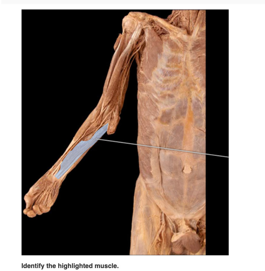 Solved Identify the highlighted muscle. | Chegg.com