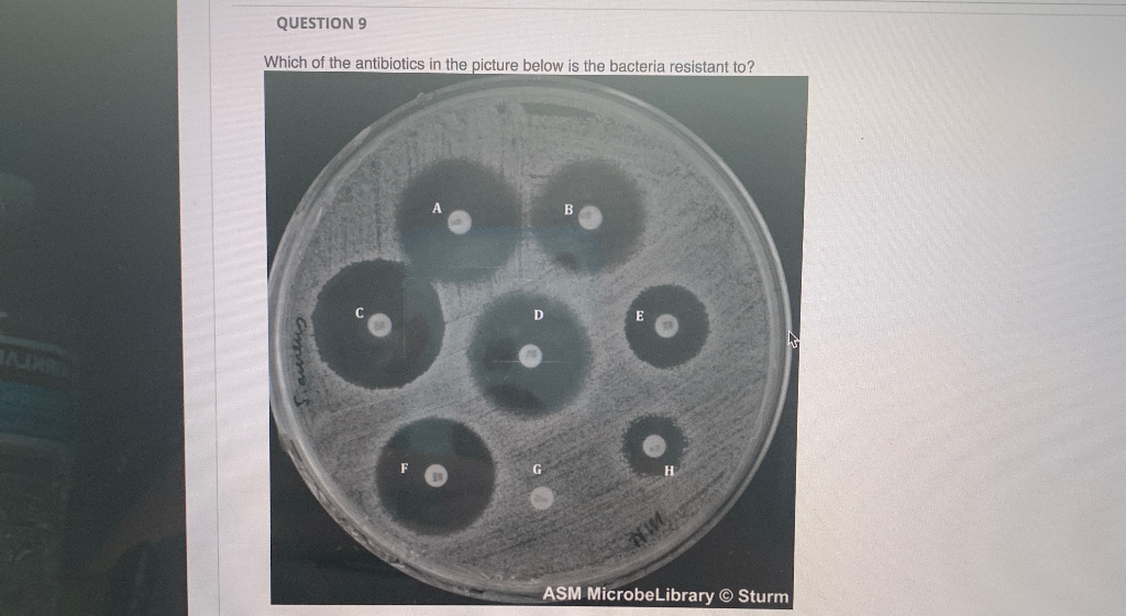 Solved QUESTIONS Which of the antibiotics in the picture | Chegg.com