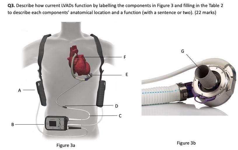 Solved Q3. Describe how current LVADs function by labelling | Chegg.com
