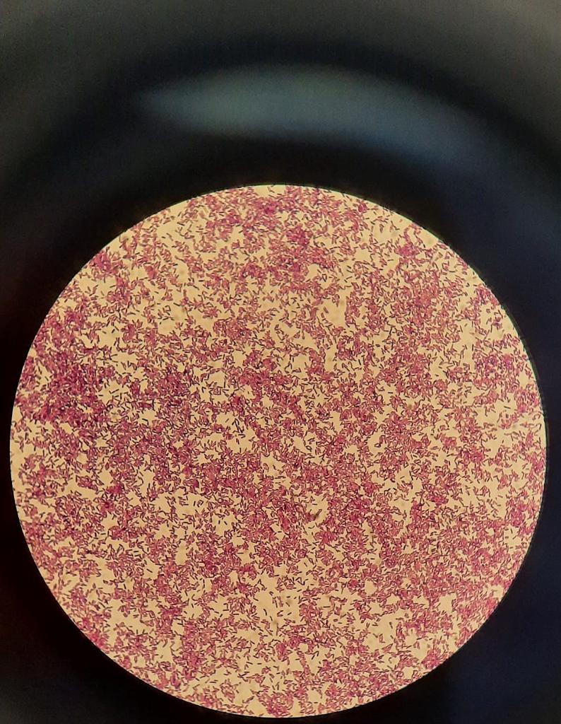 Solved 1. Can we use the urease test and KIA test to | Chegg.com