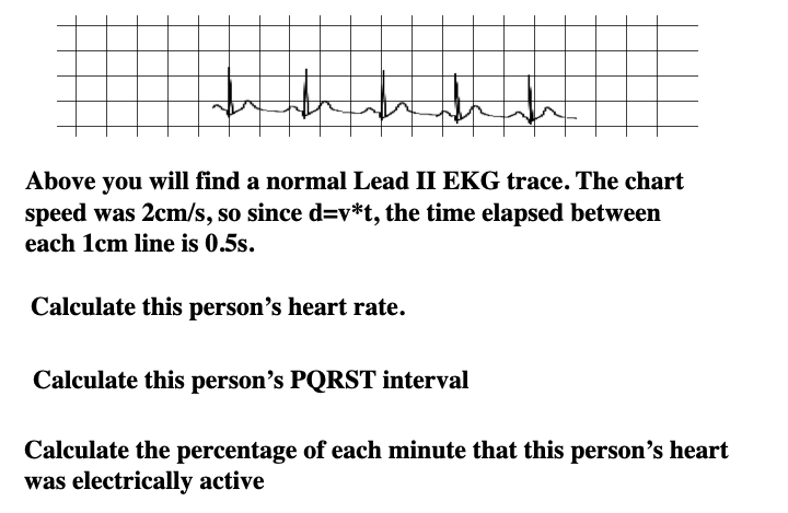 Solved Above you will find a normal Lead II EKG trace. The | Chegg.com