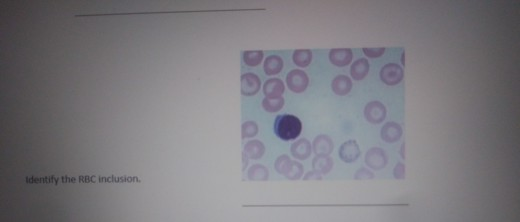 Solved 8930 Identify the RBC inclusion | Chegg.com