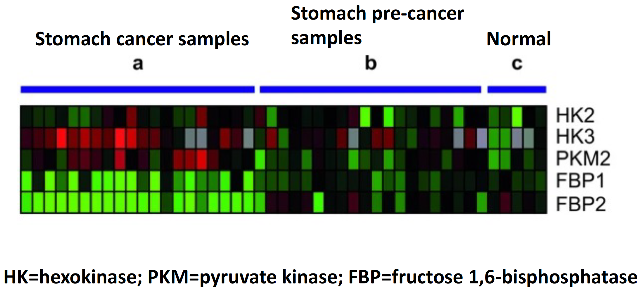 Solved Below are microarray results from normal (c), | Chegg.com