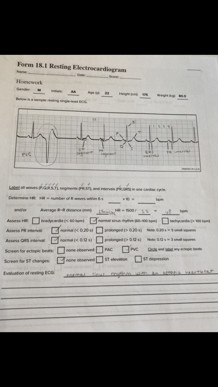 Please check my answers above and explain to me the | Chegg.com