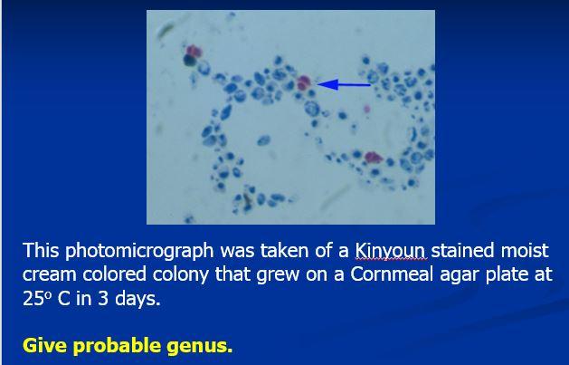 Solved This photomicrograph was taken of a Kinyoun stained | Chegg.com