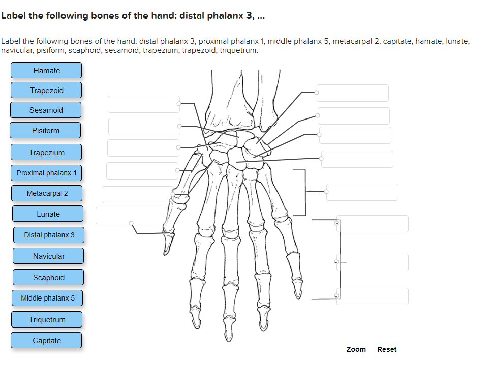 Solved Label The Following Bones Of The Hand Distal Phalanx