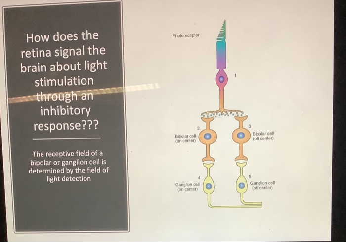 Solved How does the retina signal the brain about light | Chegg.com