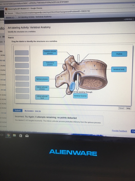 art-labeling activity: vertebral anatomy ... art-labeling activity: vertebral anatomy ...