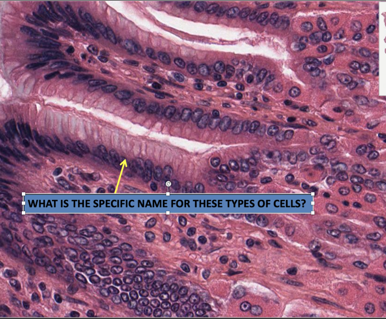 Solved A. Pseudostratified columnar cells B. Surface Mucous | Chegg.com
