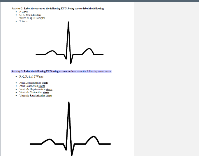 Solved Activity 2: Label the waves on the following ECG, | Chegg.com