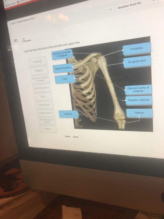 Solved Question 41 (of 47 212 points Label the bony | Chegg.com