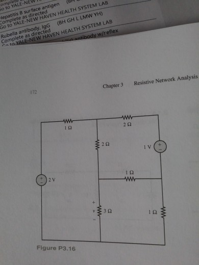 Solved using node analysis, find the voltage v across the 3 | Chegg.com