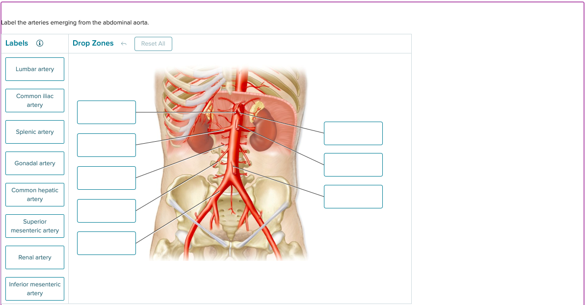 Solved Label the arteries emerging from the abdominal aorta. | Chegg.com
