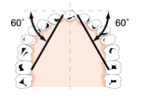 Solved An elastic string is stretched around a front tooth | Chegg.com