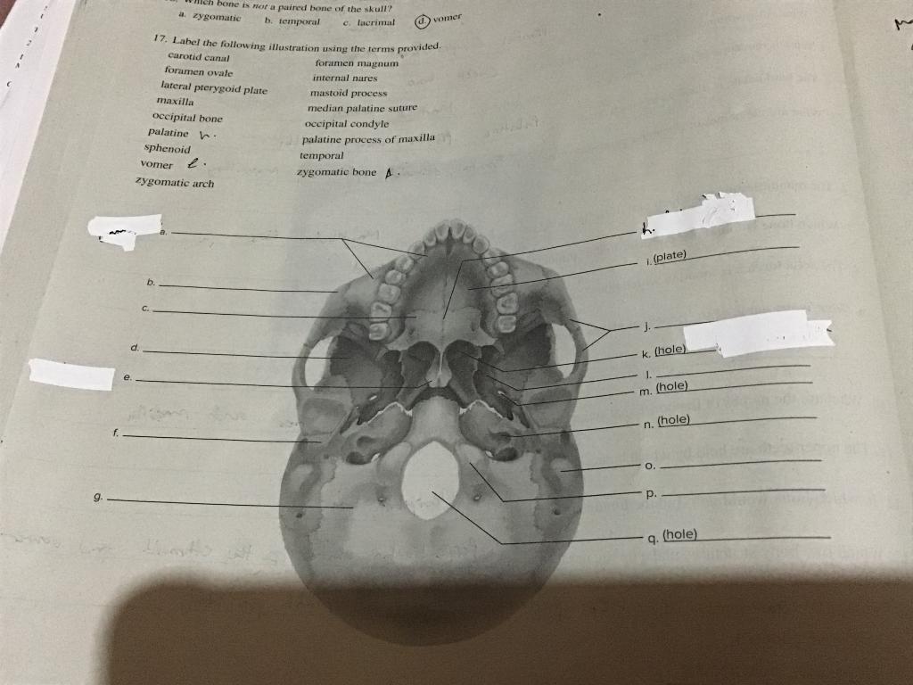 Solved a. zygomatic b. temporal c. lacrimal (d.) vomer 17. | Chegg.com