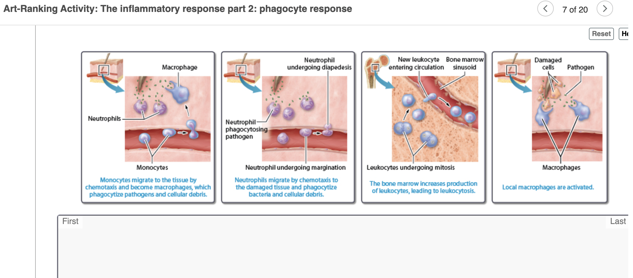 Inflammatory Response Steps