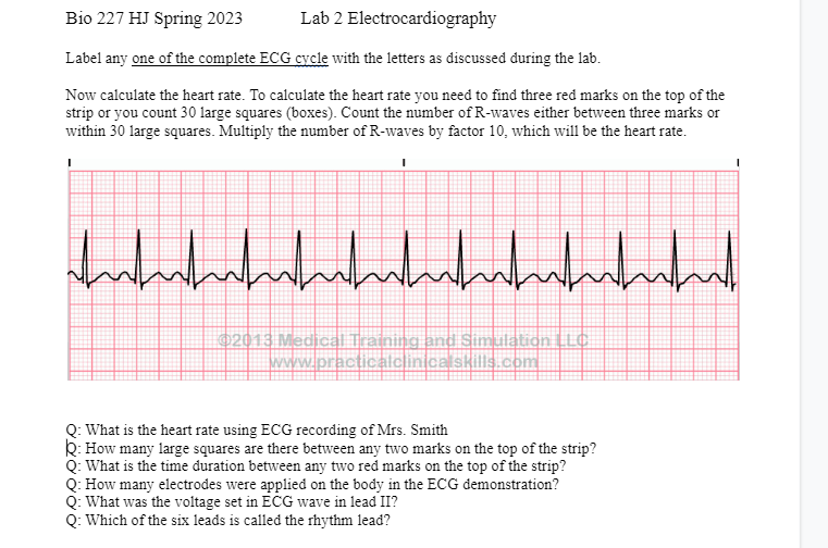 Solved Label any one of the complete ECG cycle with the | Chegg.com
