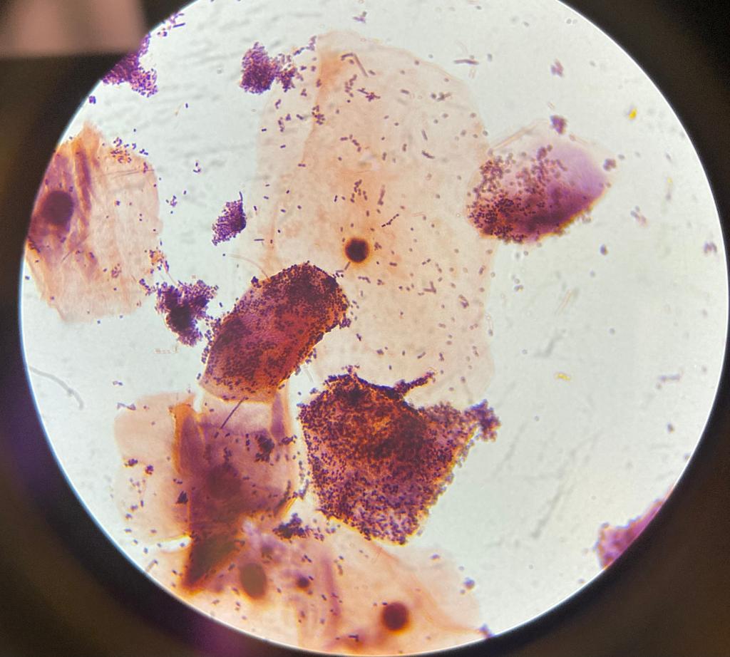 Solved EXAMINATION OF ORAL SMEAR 4. Illustrate, "in | Chegg.com