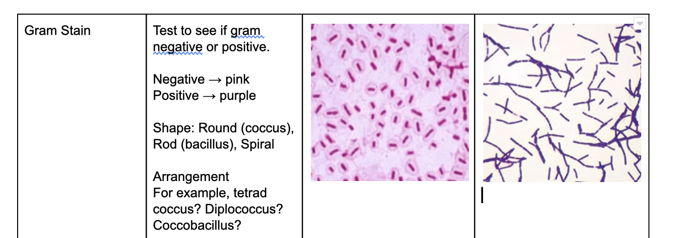 Solved Gram Stain Test to see if gram negative or positive. | Chegg.com