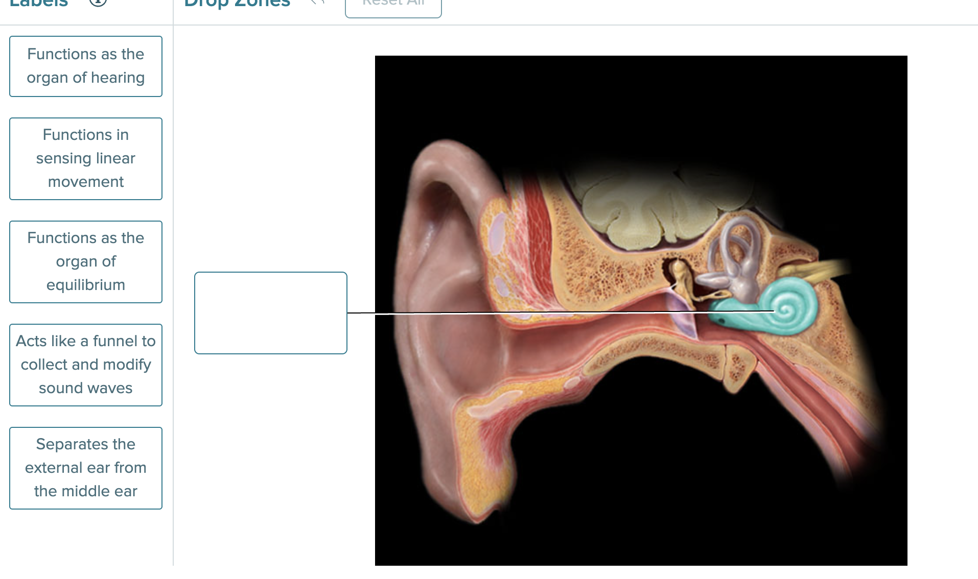 Solved Functions as the organ of hearing Functions in | Chegg.com